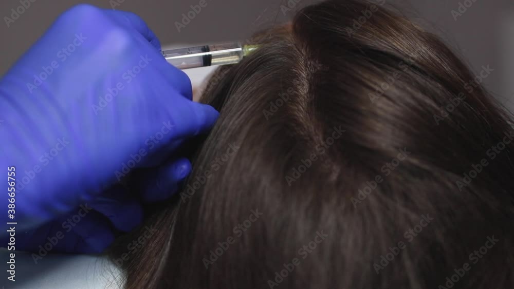 The doctor makes injections into the scalp for hair growth. Mesotherapy ...