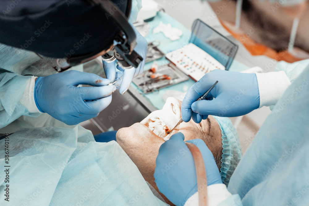 Dentists will perform an operation, implant placement. Real operation ...