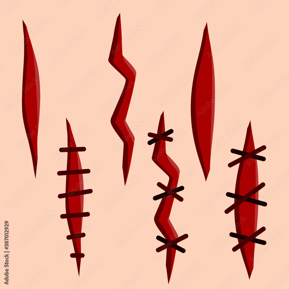 Bloody wound. Set of scratches. Stitches and medical care. Template for ...