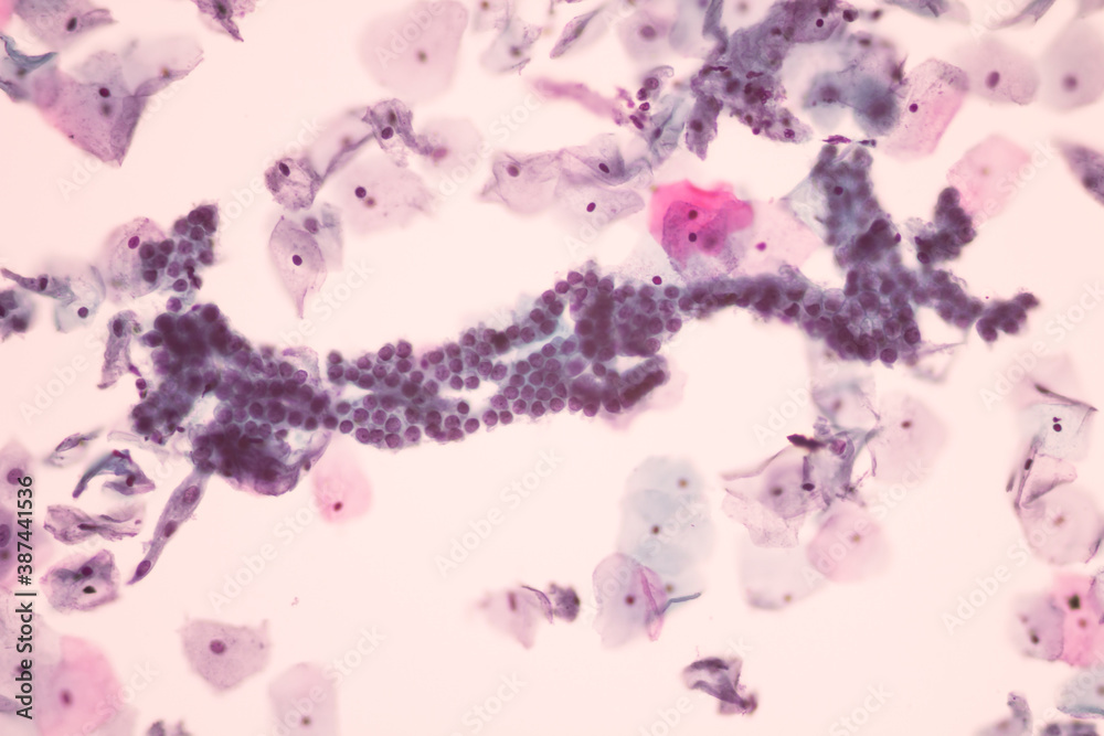 View in microscopic of normal human cervix cells.Squamous epithelium ...