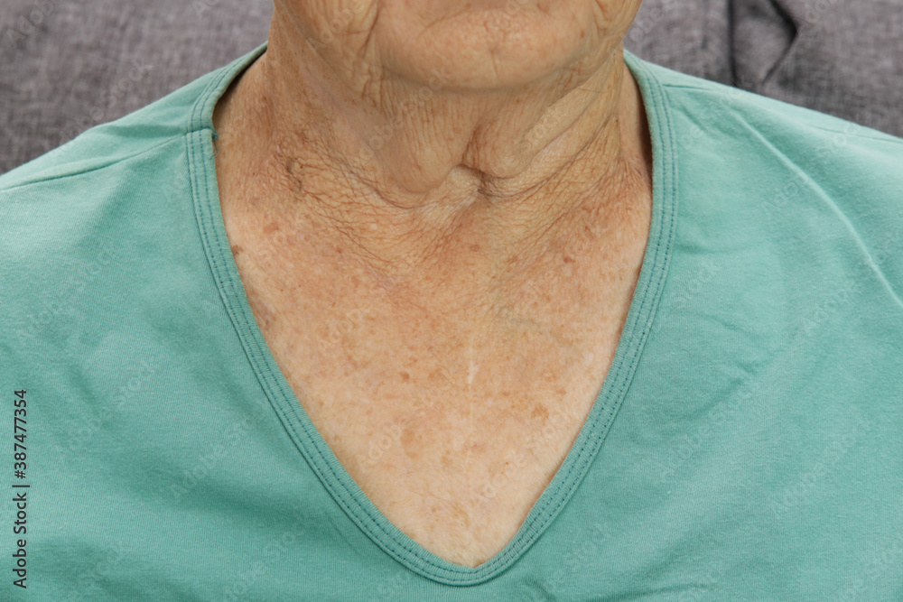Chest and neck of a very old woman, close up with non edit skin texture ...