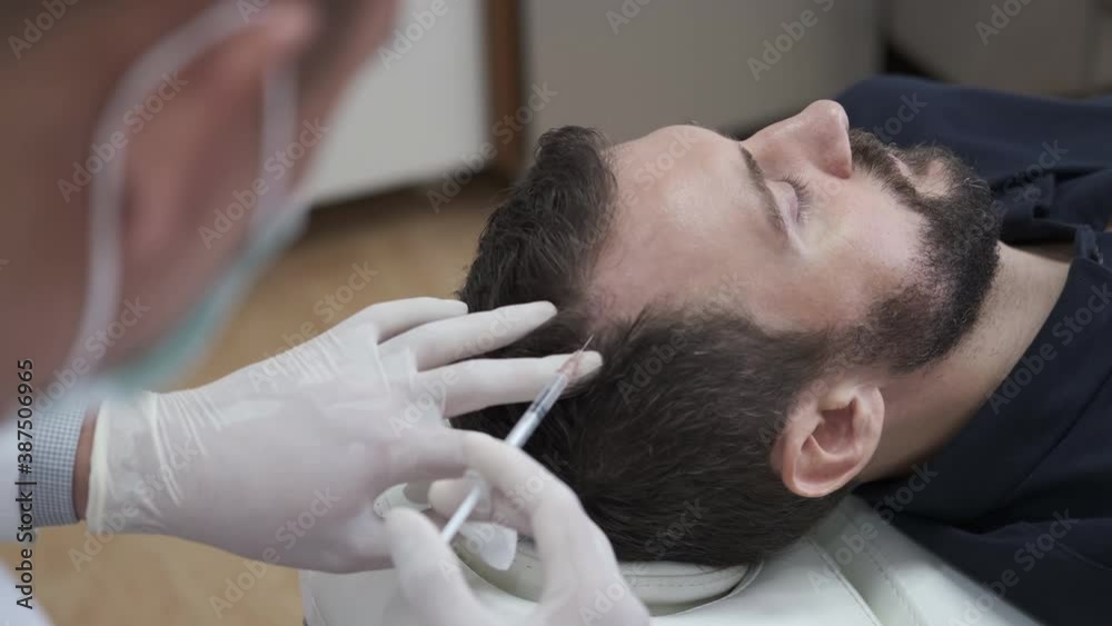 Hair mesotherapy or scalp prp: Platelet-rich plasma procedure ...