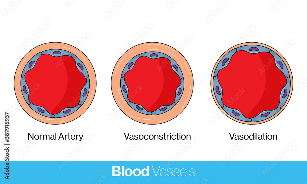 Blood vessels or capillaries or artery showing vasoconstriction and ...