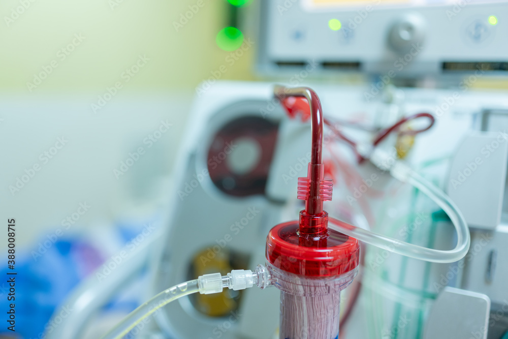 The specialist are checking continuous renal replacement therapy ...