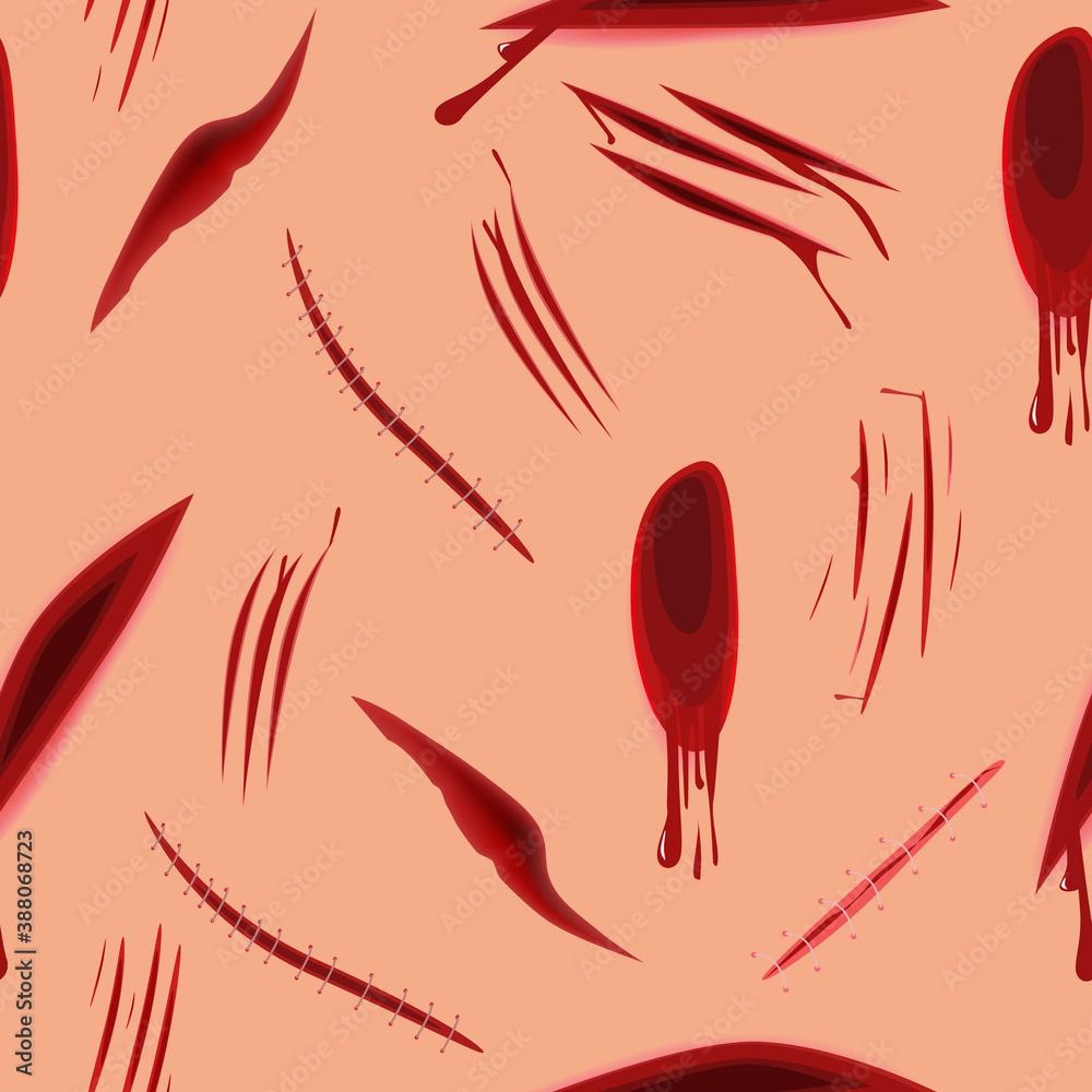 Wounds and cuts on body seamless pattern. Traumatic lacerations with ...