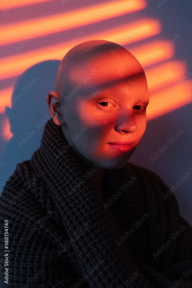 Young hairless model with striped shadows on face Stock Photo | Adobe Stock
