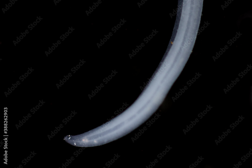 Schistosoma is a genus of trematodes, commonly known as blood flukes ...
