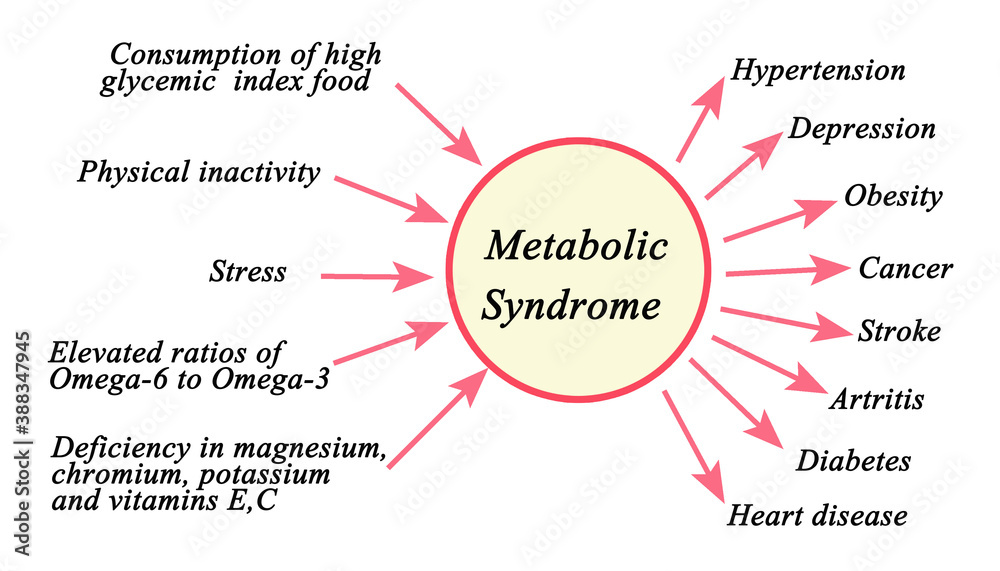 Metabolic Syndrome: causes and consecuences Stock Illustration | Adobe ...