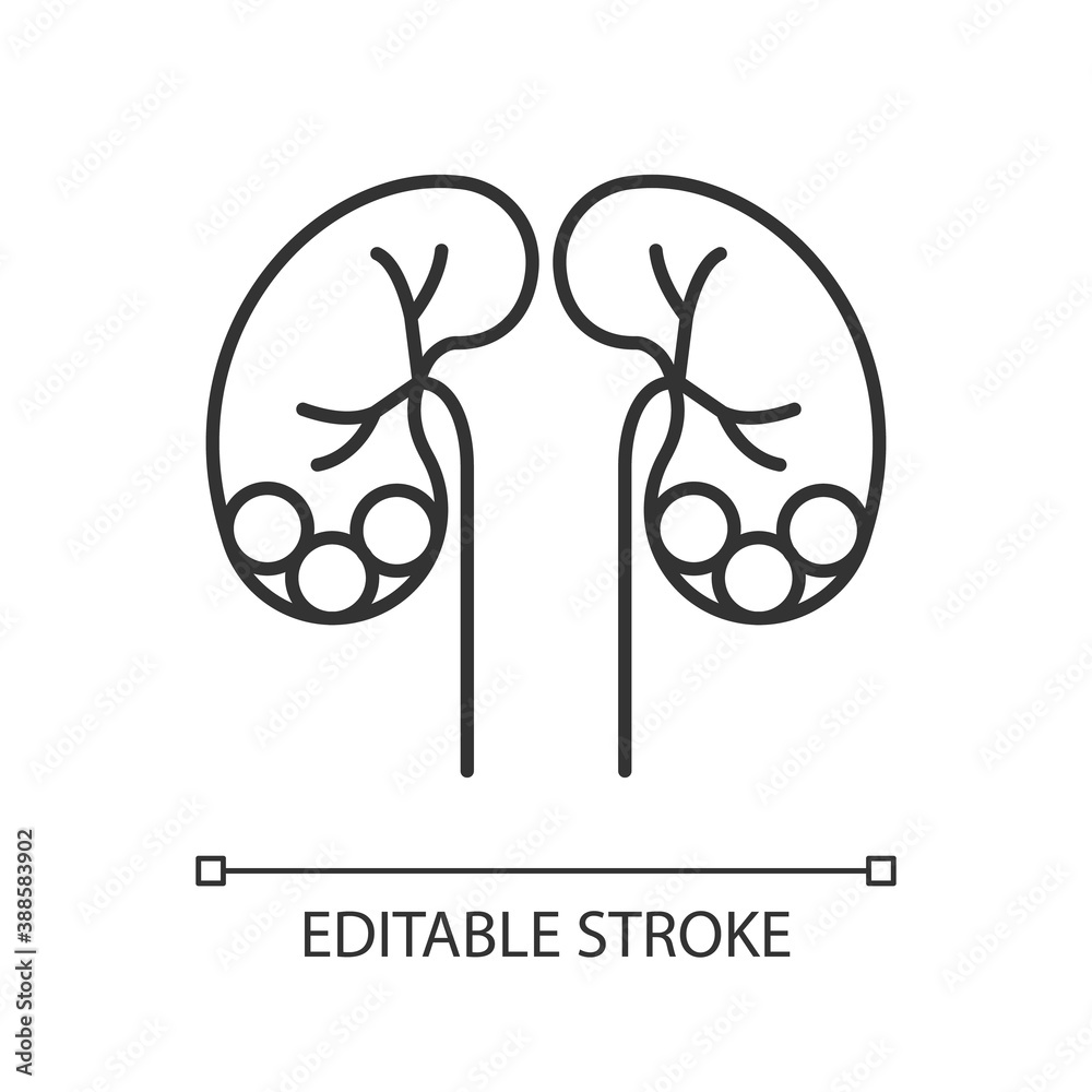 Kidney stone disease linear icon. Dissolved minerals and salts ...