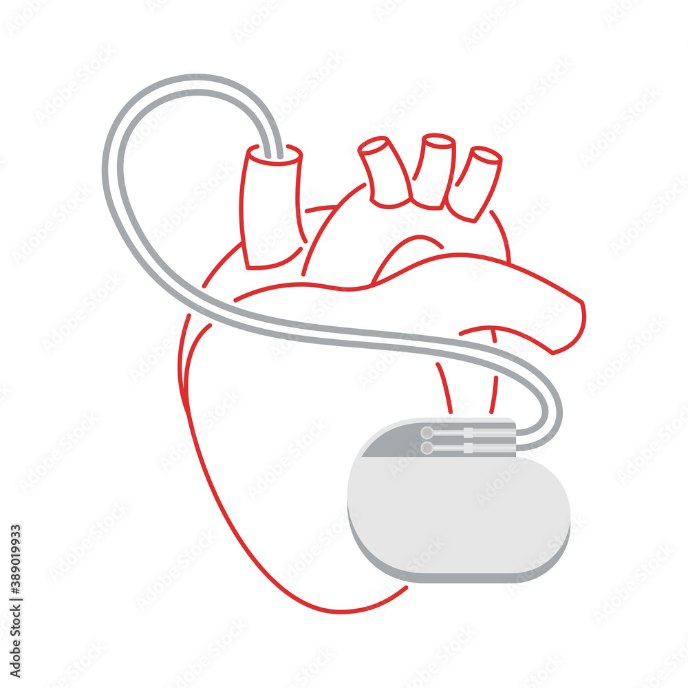Pacemaker thin line illustration - human heart and cardio implant ...
