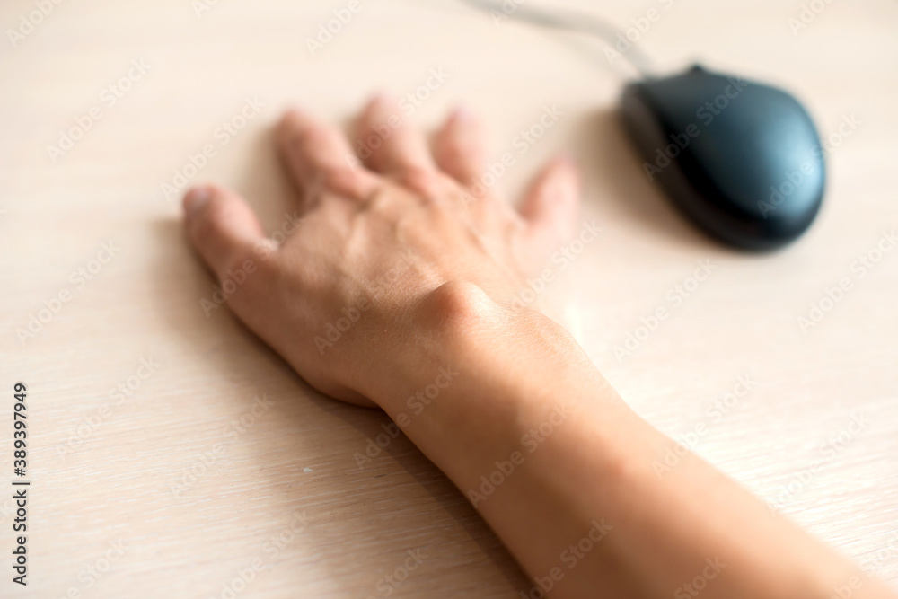 female hand with a hygroma. Pain. Wrist ganglion cyst. Treatment ...