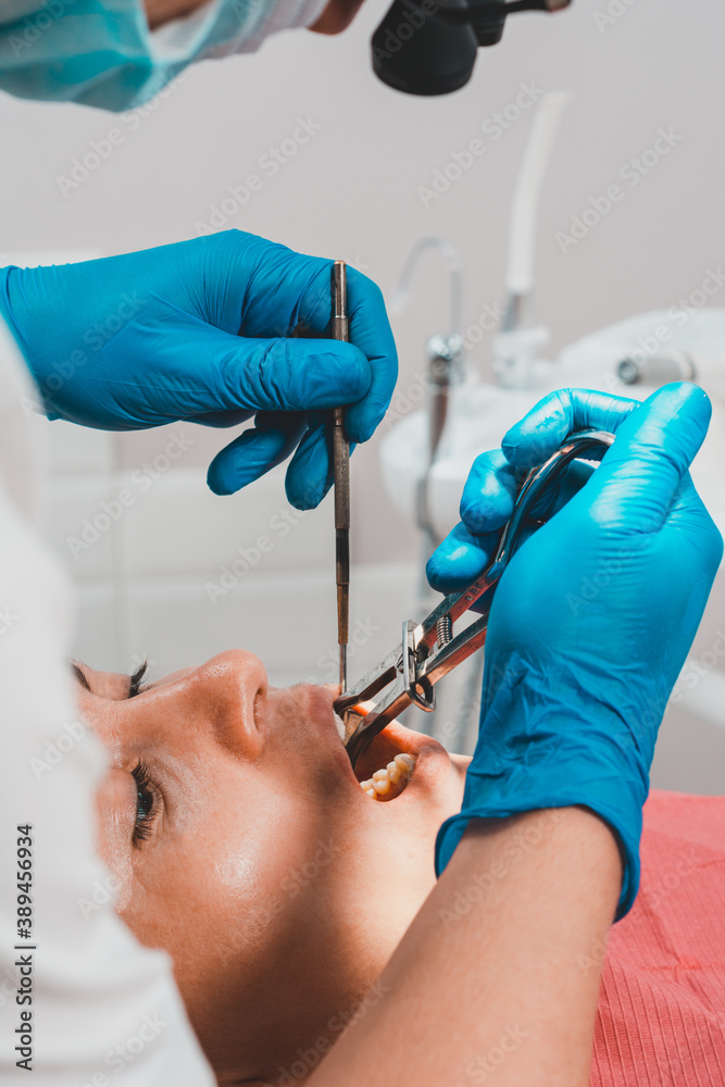 Installation of a rubber dam with a metal clamp for dental fillings ...