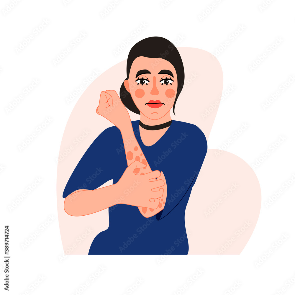 Allergic rash reaction isolated on white vector illustration. Female ...