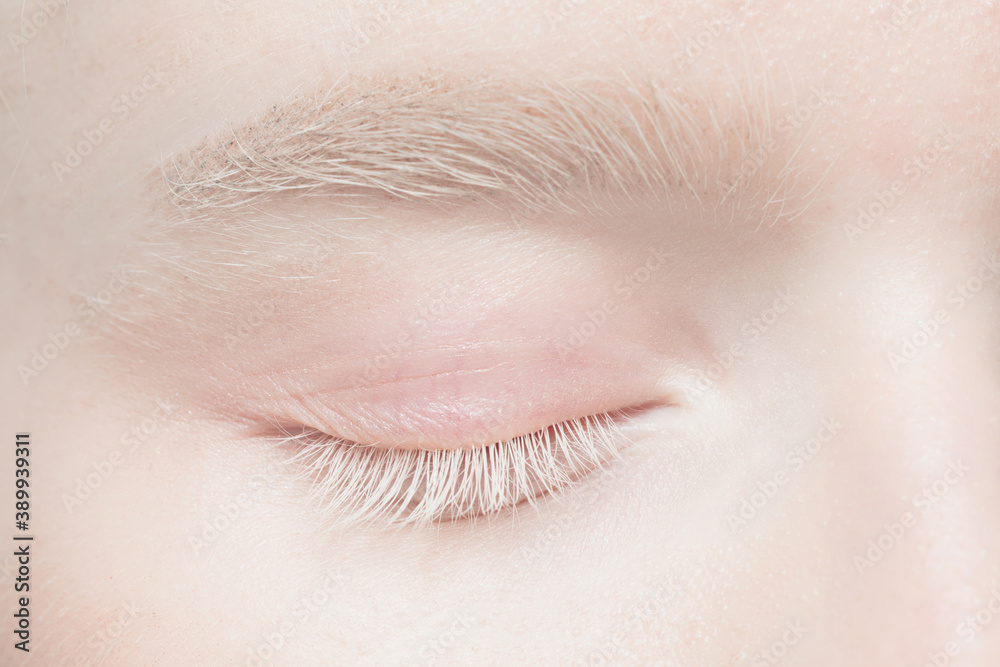 Brow and eyelid. Close up portrait of beautiful albino female model ...