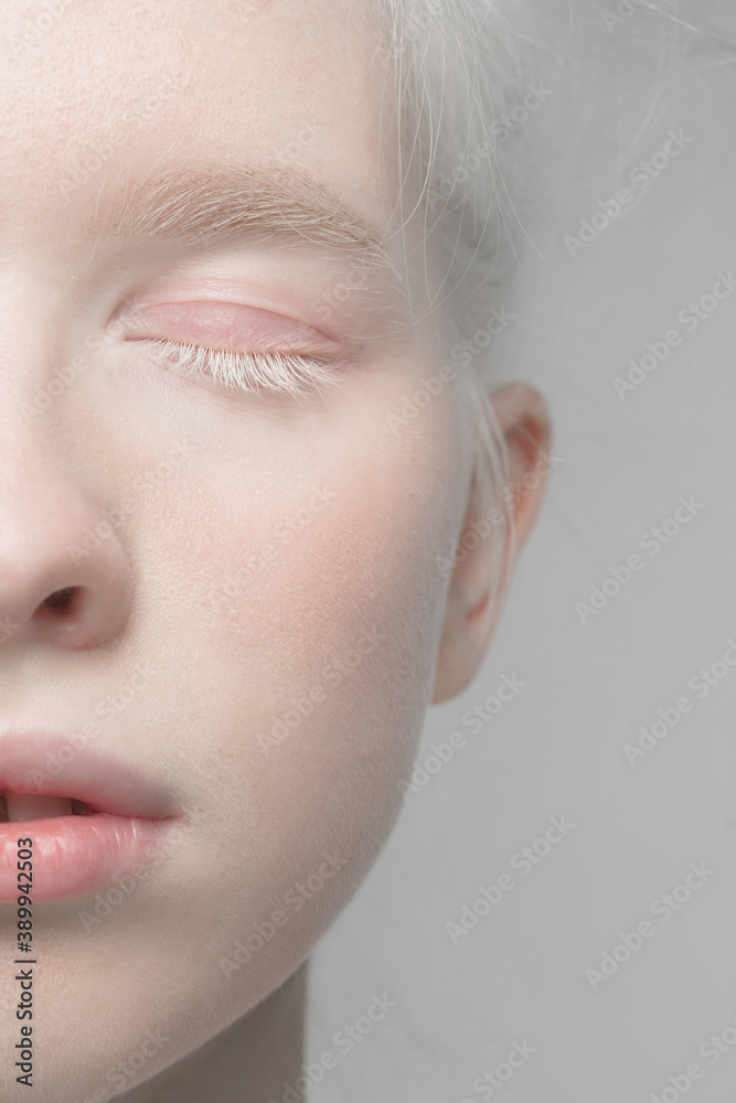 Eyes closed. Close up portrait of beautiful albino female model. Parts ...