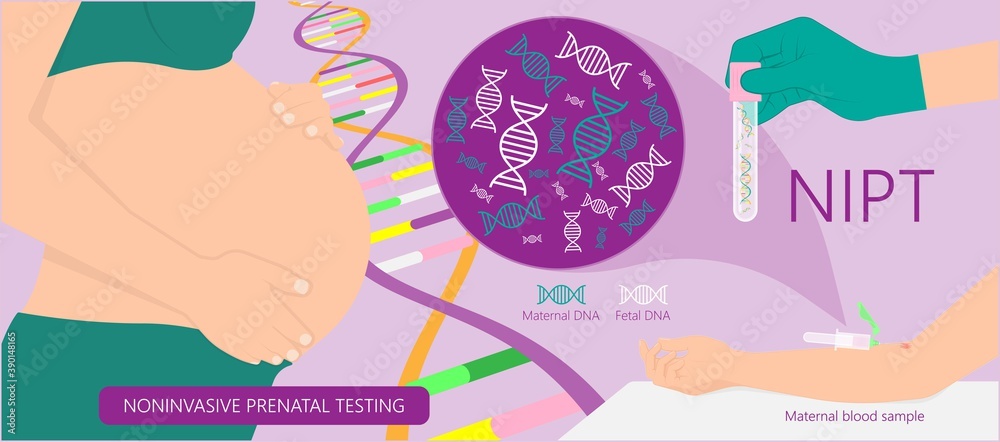 Noninvasive prenatal testing NIPT screening genetic disorders ...