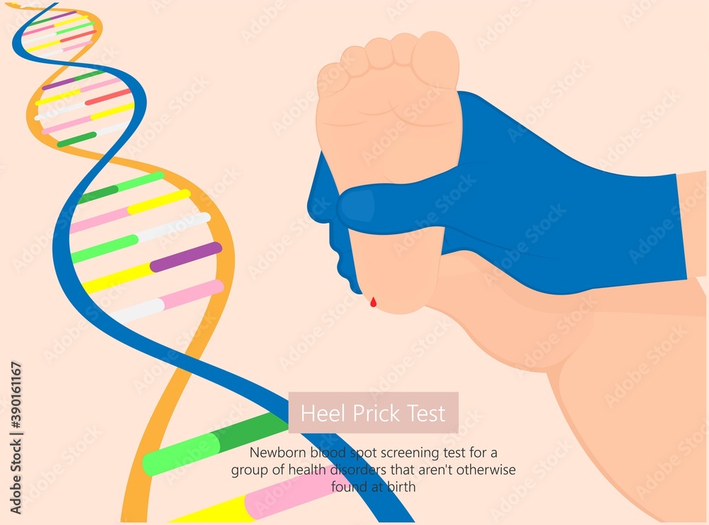 Newborn screening neonate metabolism rare paper filter Guthrie puncture ...