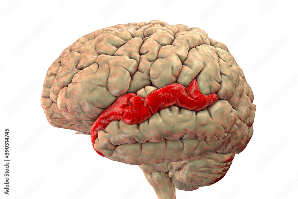 Human brain with highlighted superior temporal gyrus Stock Illustration ...