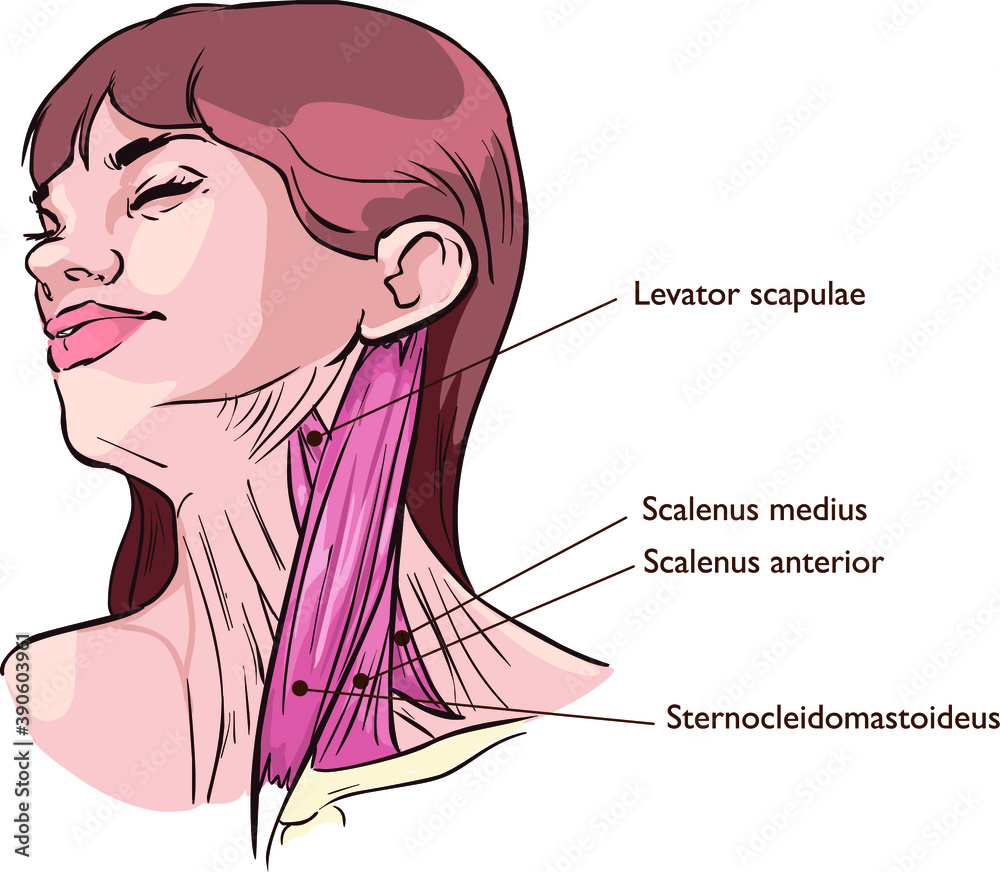 Vector illustration of Neck muscles anatomy Stock Vector | Adobe Stock