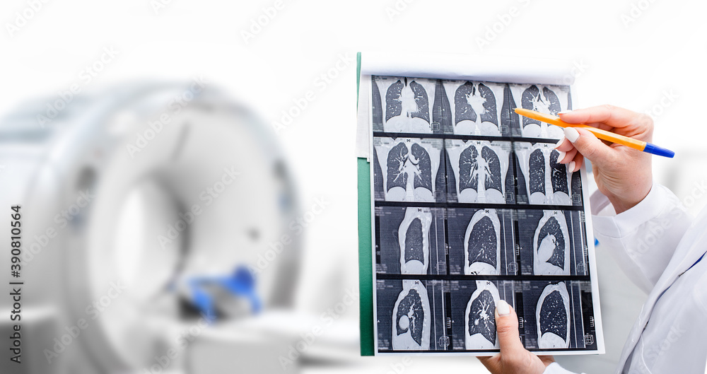 Radiologist showing tomography scan of a patient's lungs over of CT ...
