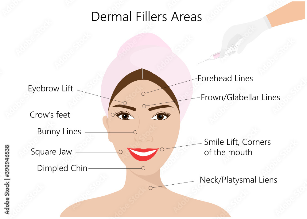 Dermal filler injections areas. Woman face with doctor hands in gloves ...