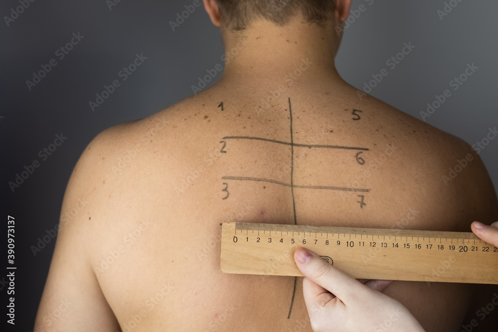 An allergist or dermatologist examines red spots on a man’s face. The ...
