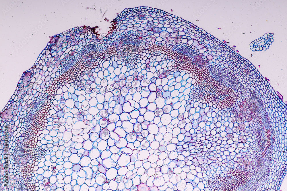 Zygomycota, or zygote fungi ,Downy mildew of cruzifers host tissue with ...