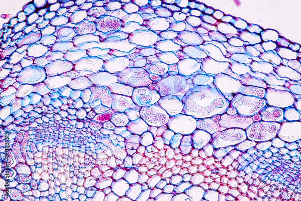 Zygomycota, or zygote fungi ,Downy mildew of cruzifers host tissue with ...
