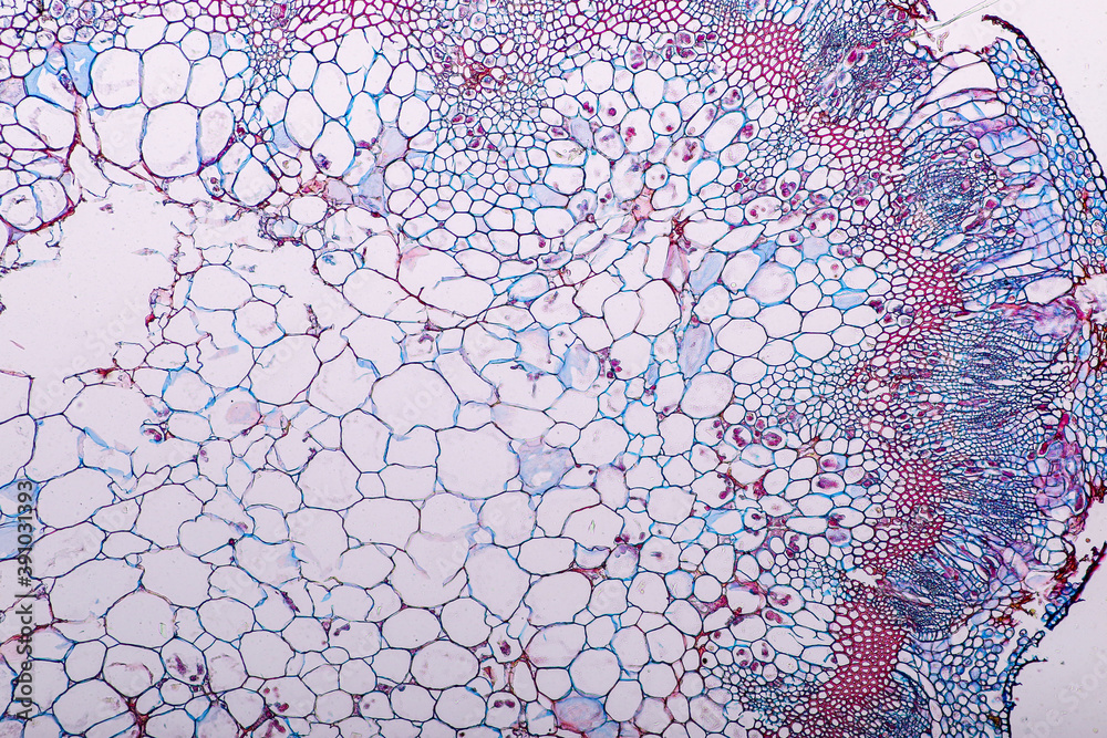 Foto de Zygomycota, or zygote fungi ,Downy mildew of cruzifers host ...