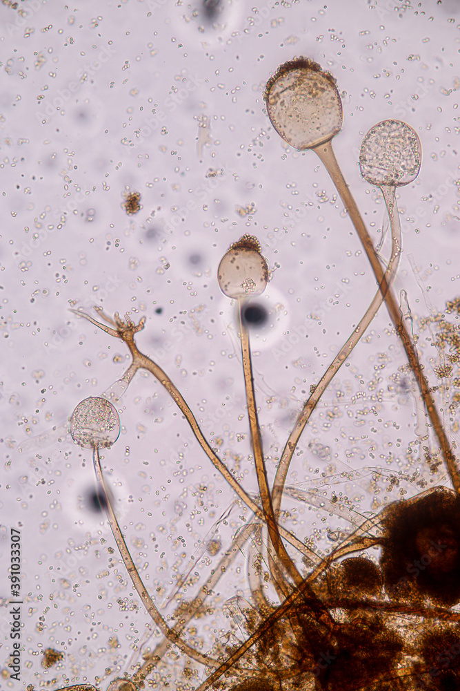 Characteristics of Rhizopus is a genus of common saprophytic fungi on ...