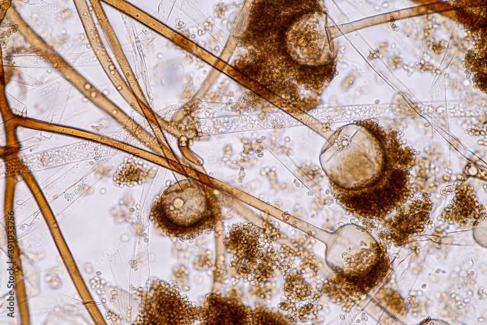 Characteristics of Rhizopus is a genus of common saprophytic fungi on ...