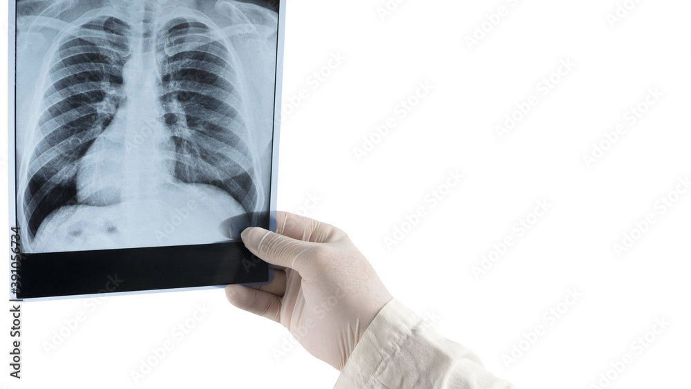 X-ray of the lungs isolated on white place for text, close-up, image of ...