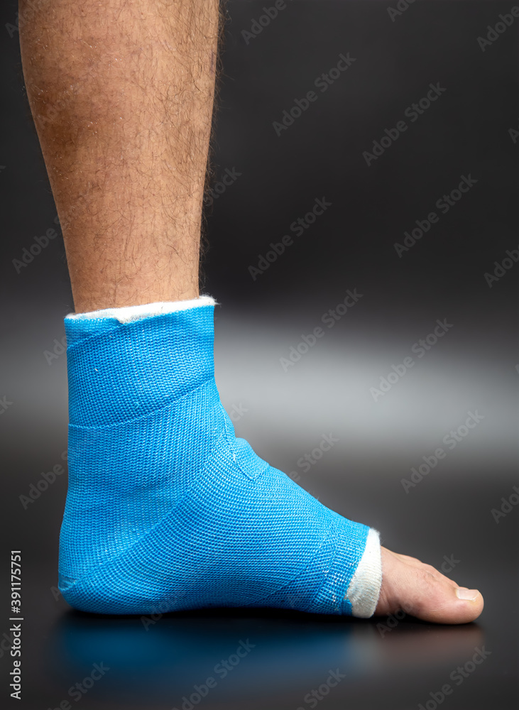 Close up photos of foot blue splint for treatment of injuries from ...