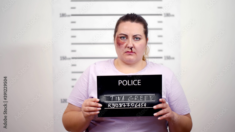 Overweight young criminal woman with bruises on face holding board ...