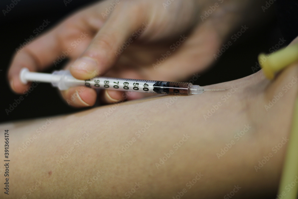 Side photo of the arm of a drug addict, while taking drugs with a ...