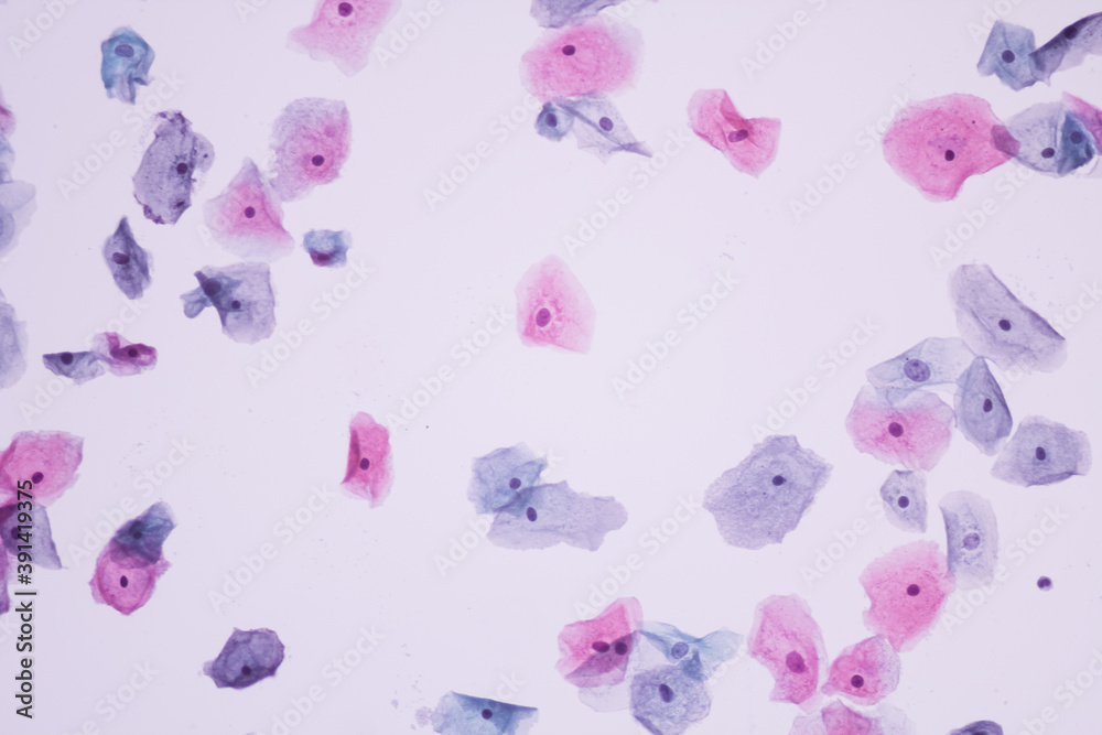 View in microscopic of human skin cells.Squamous epithelium cells ...