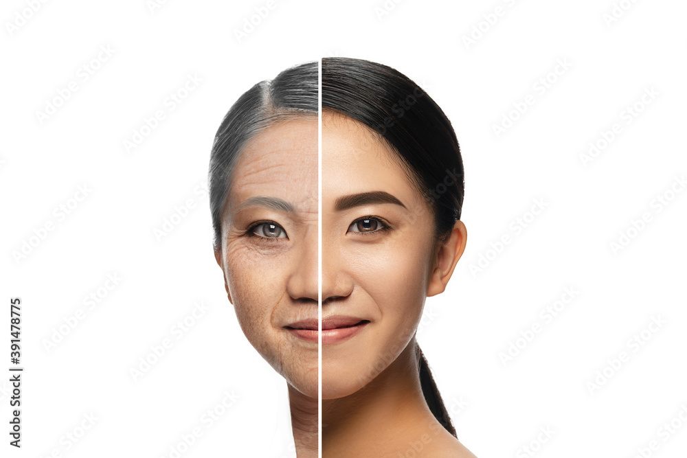 Comparison. Portrait of beautiful asian woman with problem and clean ...