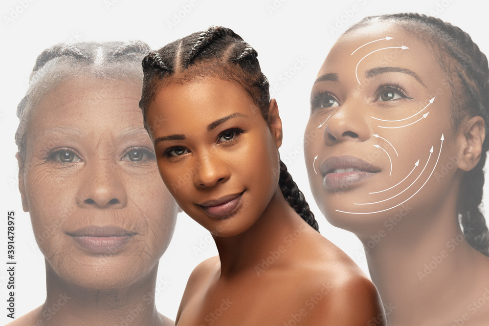 Comparison. Portrait of beautiful african woman with problem and clean ...