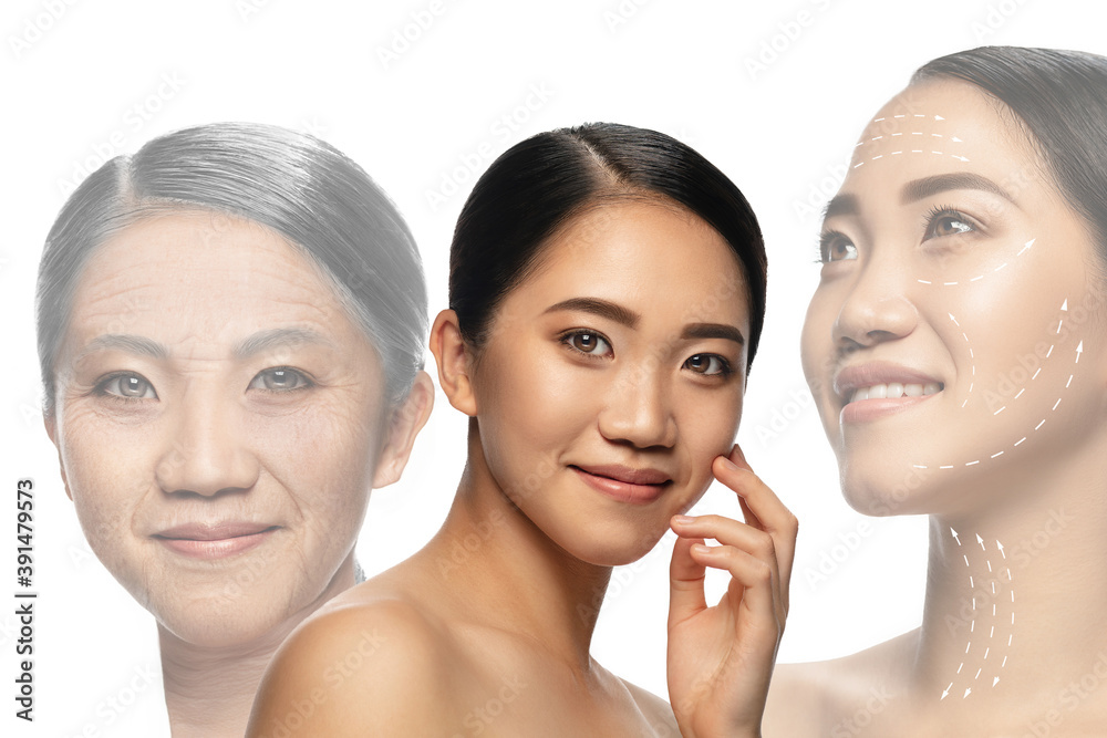 Comparison. Portrait of beautiful asian woman with problem and clean ...