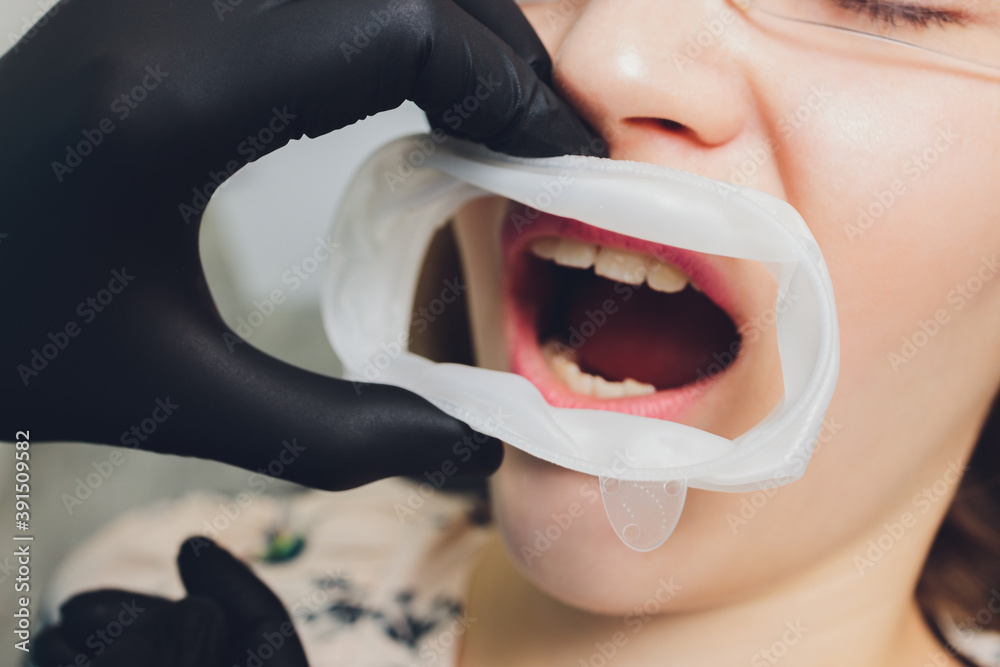 Close-up photo of a disposable dental rubber dam used for keeping soft ...