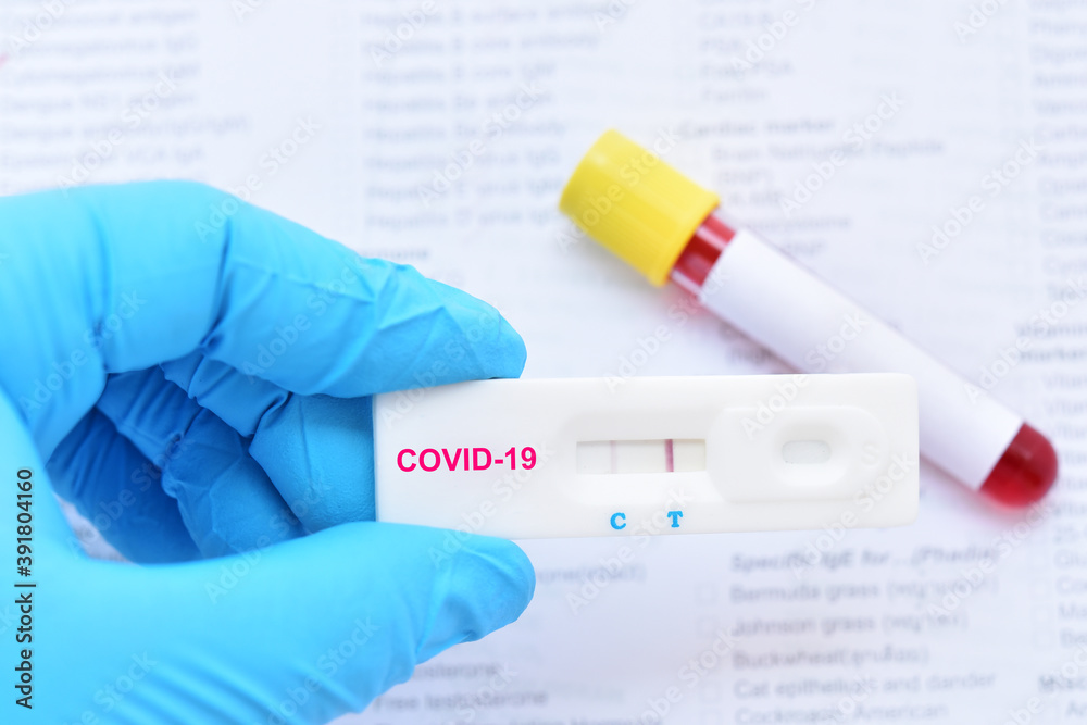 Positive test result by using rapid test device for COVID-19 virus ...