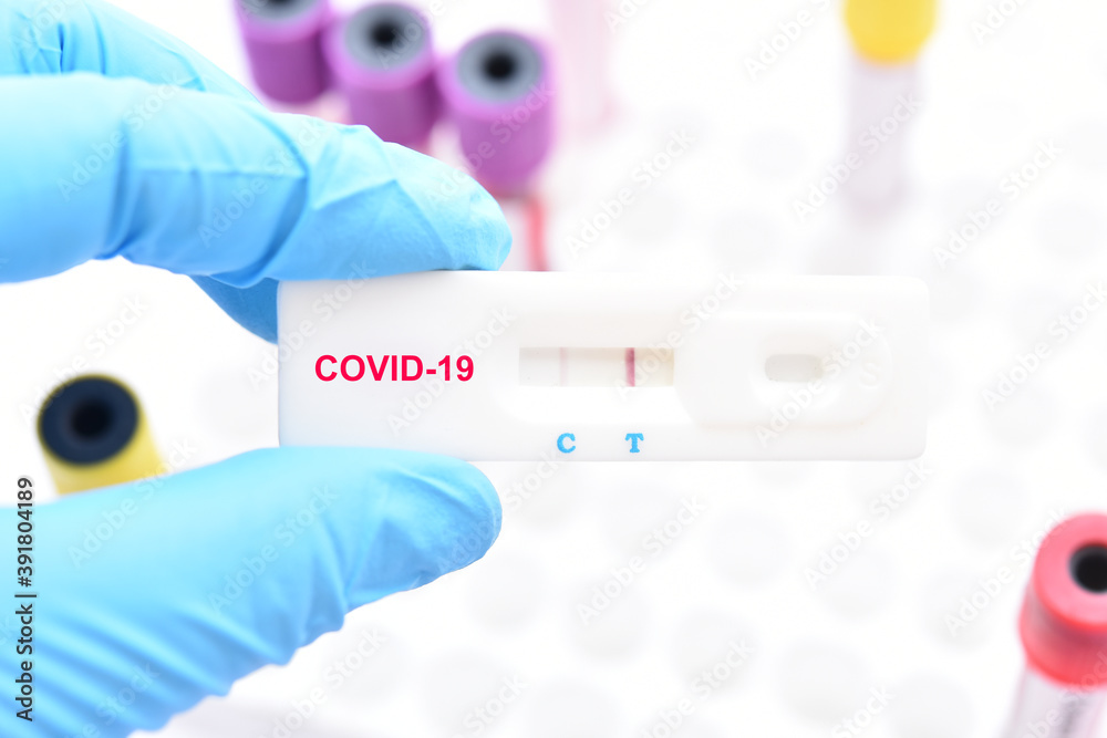 Positive test result by using rapid test device for COVID-19 virus ...