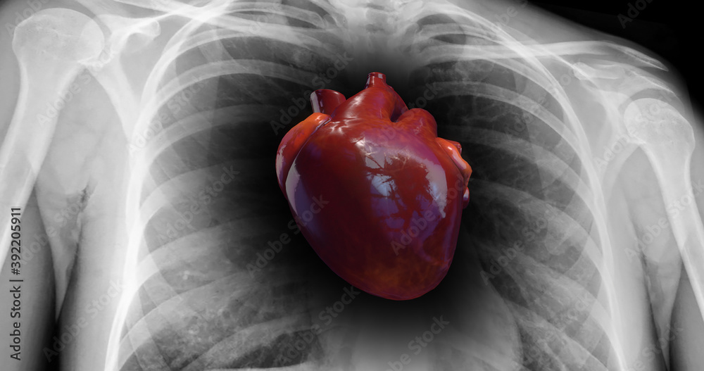 Human Heart Beat Anatomy. X-Ray Skeleton On Background. Science And ...
