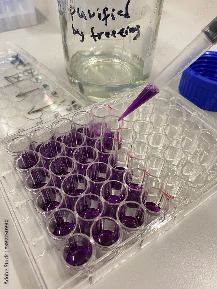 MTT assay protocol for measuring cell viability, proliferation and ...