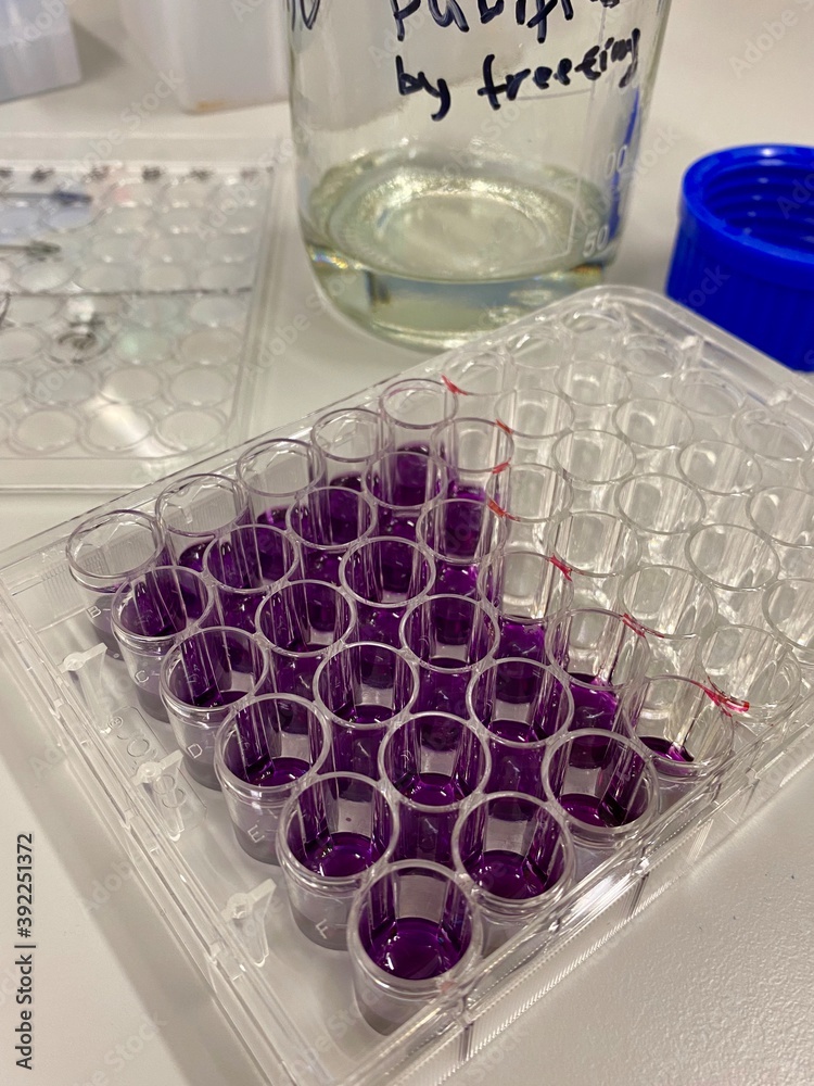 Foto de MTT assay for measuring human cell viability, proliferation and ...