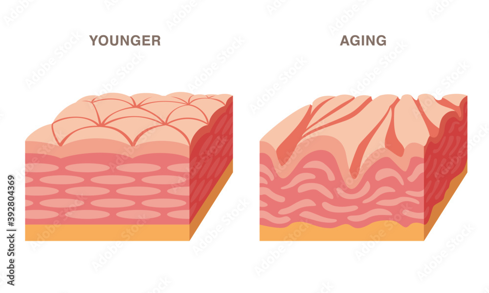 Skin Cross Section Younger And Aging Smooth And Wrinkled Pale