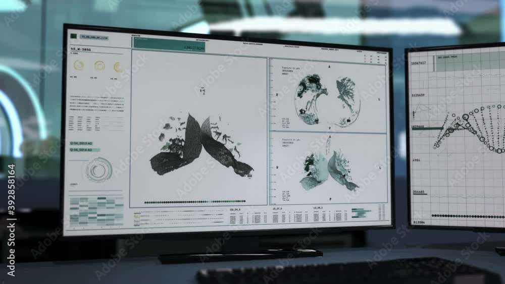 Patient’s lungs are examined at a CT scan facility. The computer ...