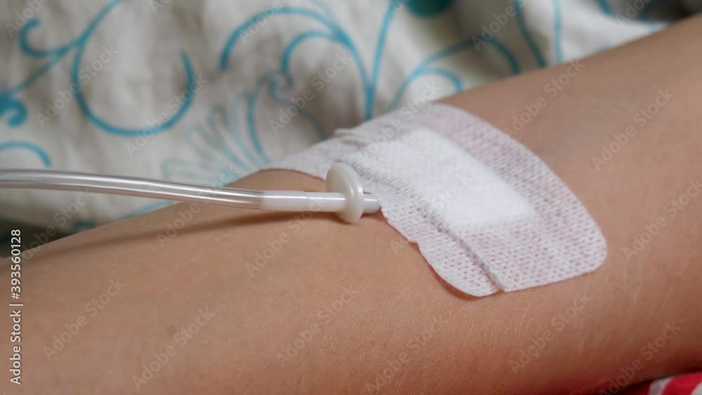 Plastic iv tube for woman hand on hospital bed, medical equipment. Ward ...