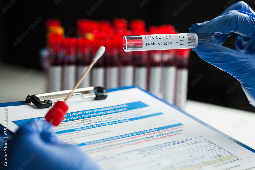 rt-PCR COVID-19 virus disease diagnostic test,lab technician wearing ...