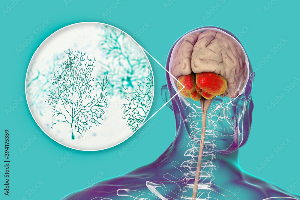 Human brain with highlighted cerebellum and close-up view of Purkinje ...